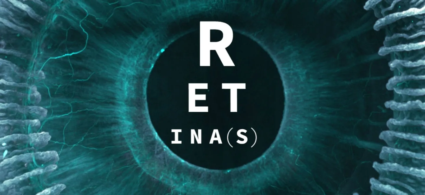 RETINA(S), a new film project by Yannik Ruault - Institut français · Écosse